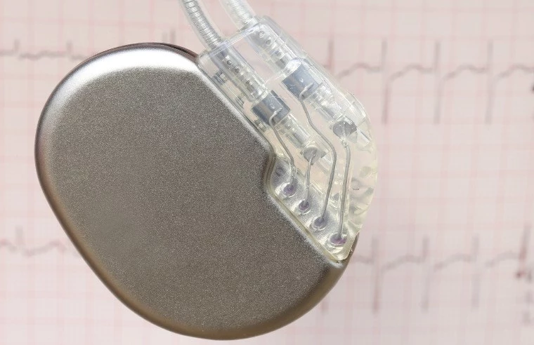 ¿SABÍAS QUÉ ES UN MARCAPASOS? | Fundación Cardiológica Argentina